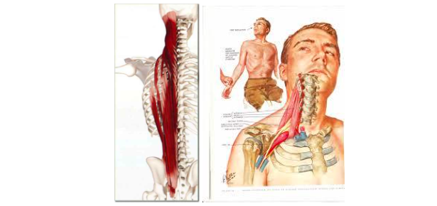 Cervical Spine Radicular Pain: Osteopaths' Targeting Tactics