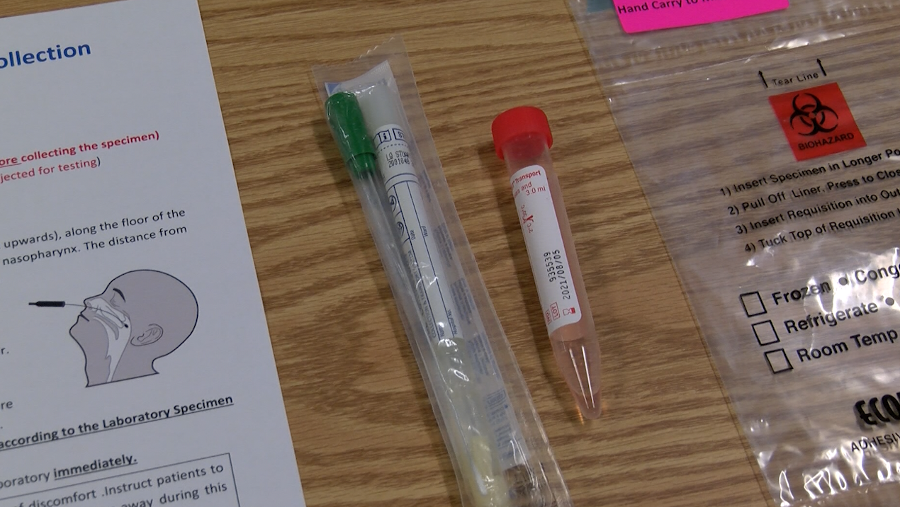 Coronavirus testing breakthrough with new Antibody kits - KYMA